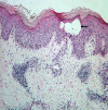 Dermatopathology CPD | StudyPRN